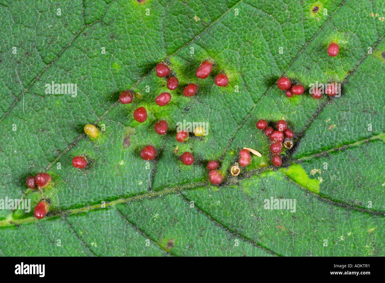 Pustules hi-res stock photography and images - Alamy
