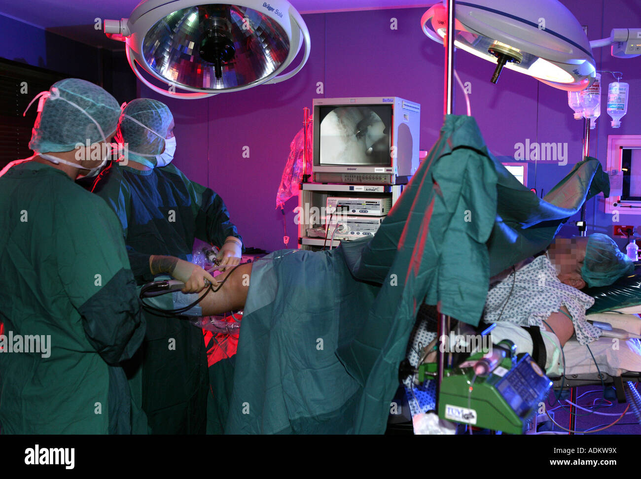 DEU, Germany : Arthroscopical operation of knee joint Stock Photo - Alamy