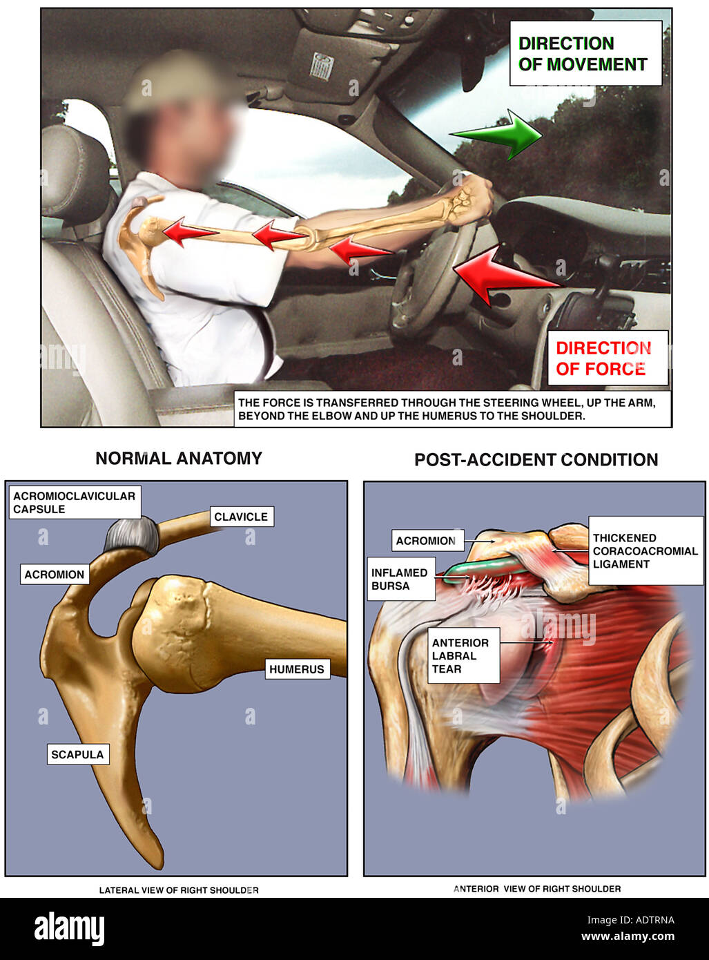 Glenohumeral High Resolution Stock Photography and Images - Alamy