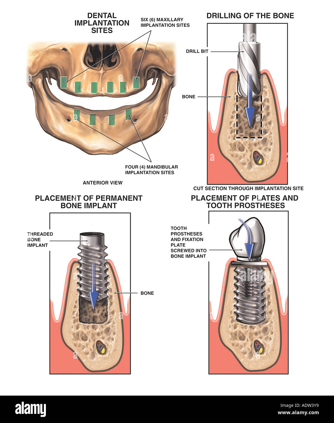 Inferior alveolar vein hi-res stock photography and images - Alamy