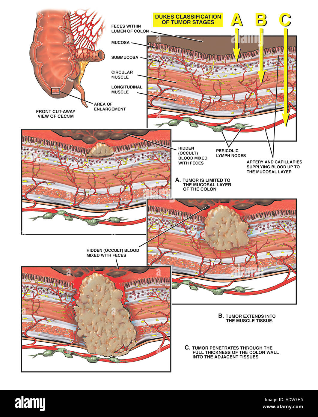 Layers Of Colon Wall