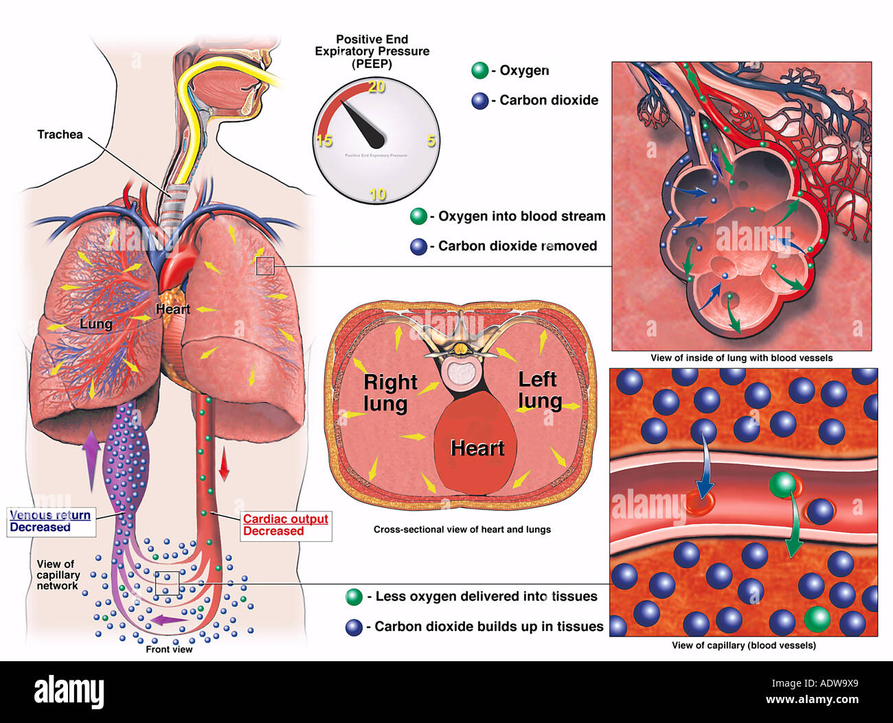 Decreased blood pressure hi-res stock photography and images - Alamy