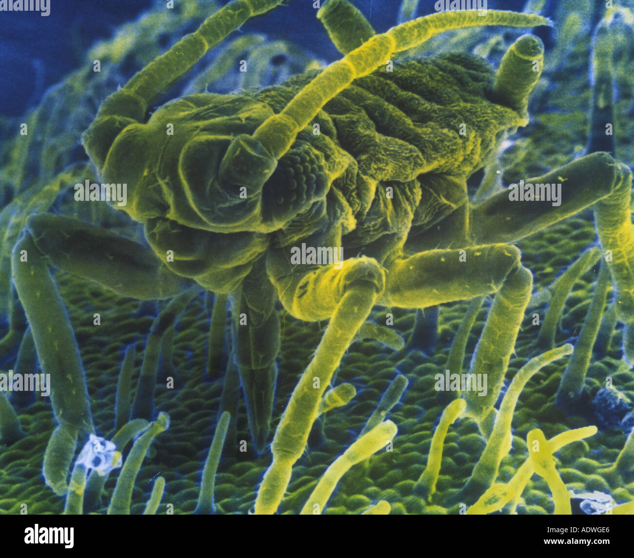 Scientific Scanning Electron Micrograph of Aphid Mag 130 1 95 9 22 ...
