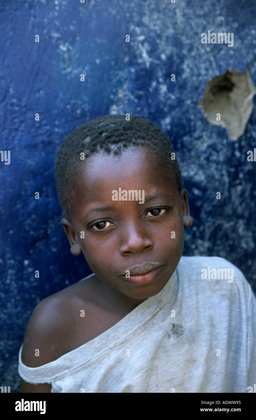 Sierra Leonean boy in a refugee camp in neighbouring Guinea Stock Photo ...