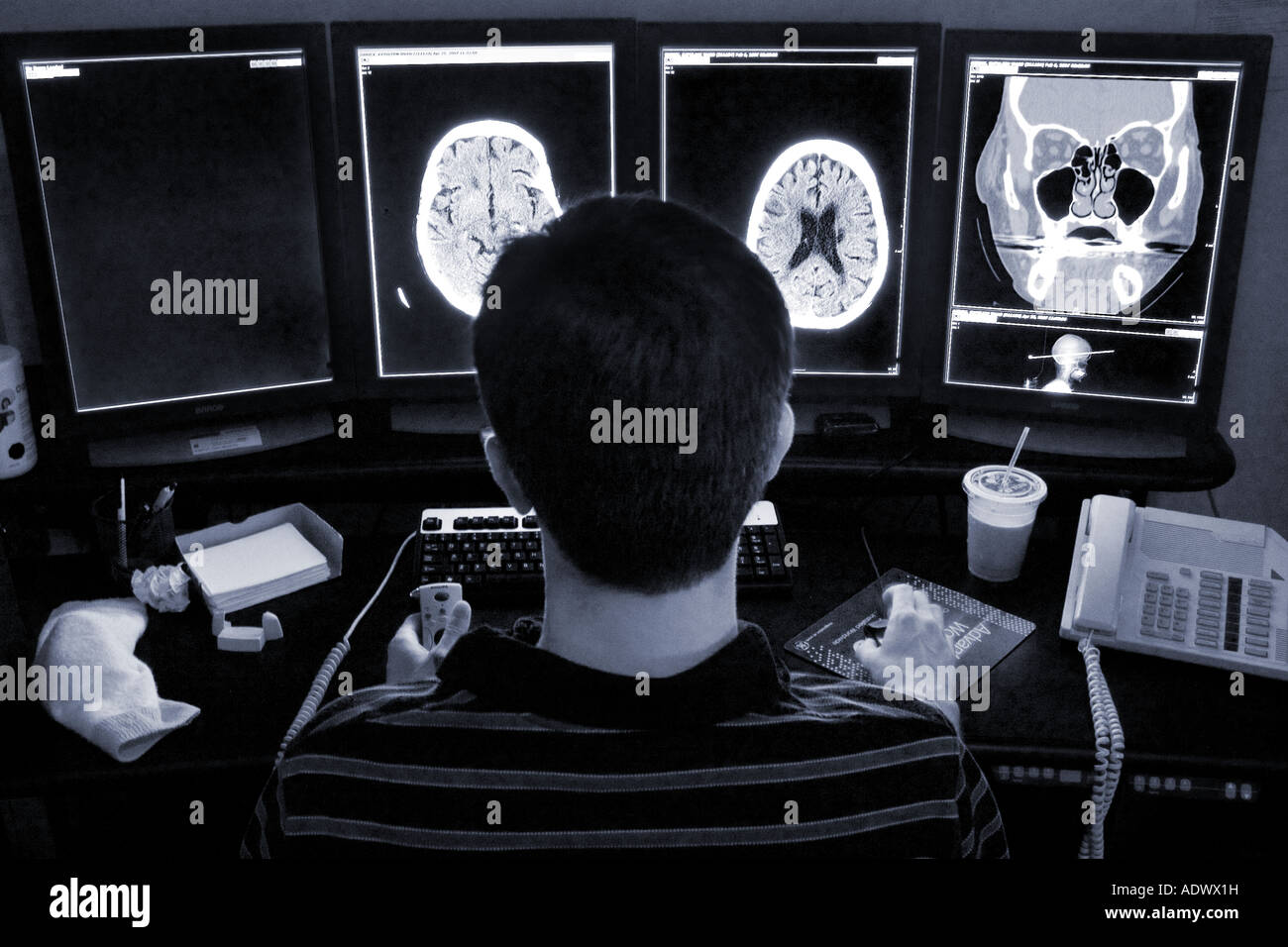 Magnetic resonance images hi-res stock photography and images - Alamy