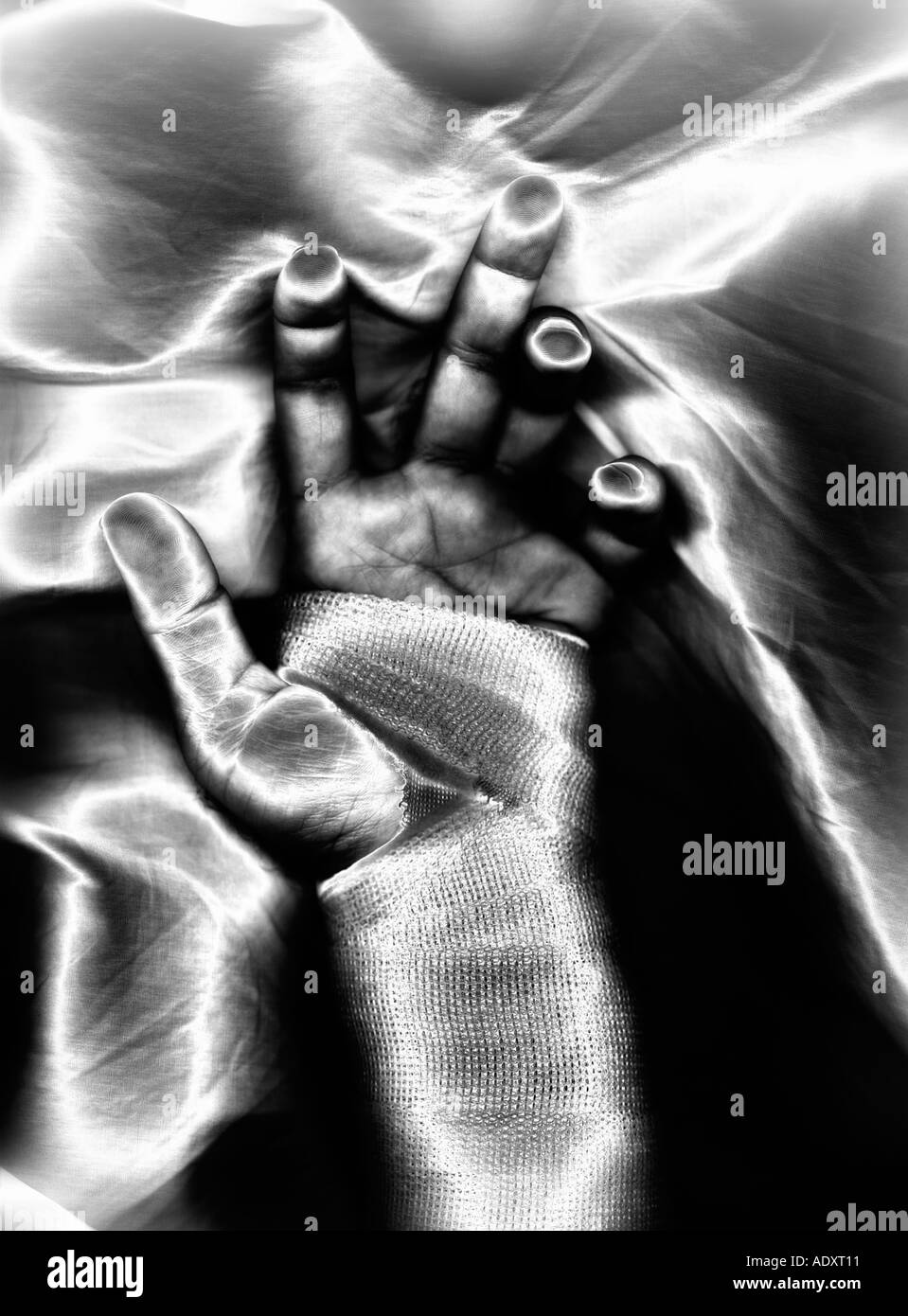 Fiberglass Cast High Resolution Stock Photography and Images - Alamy