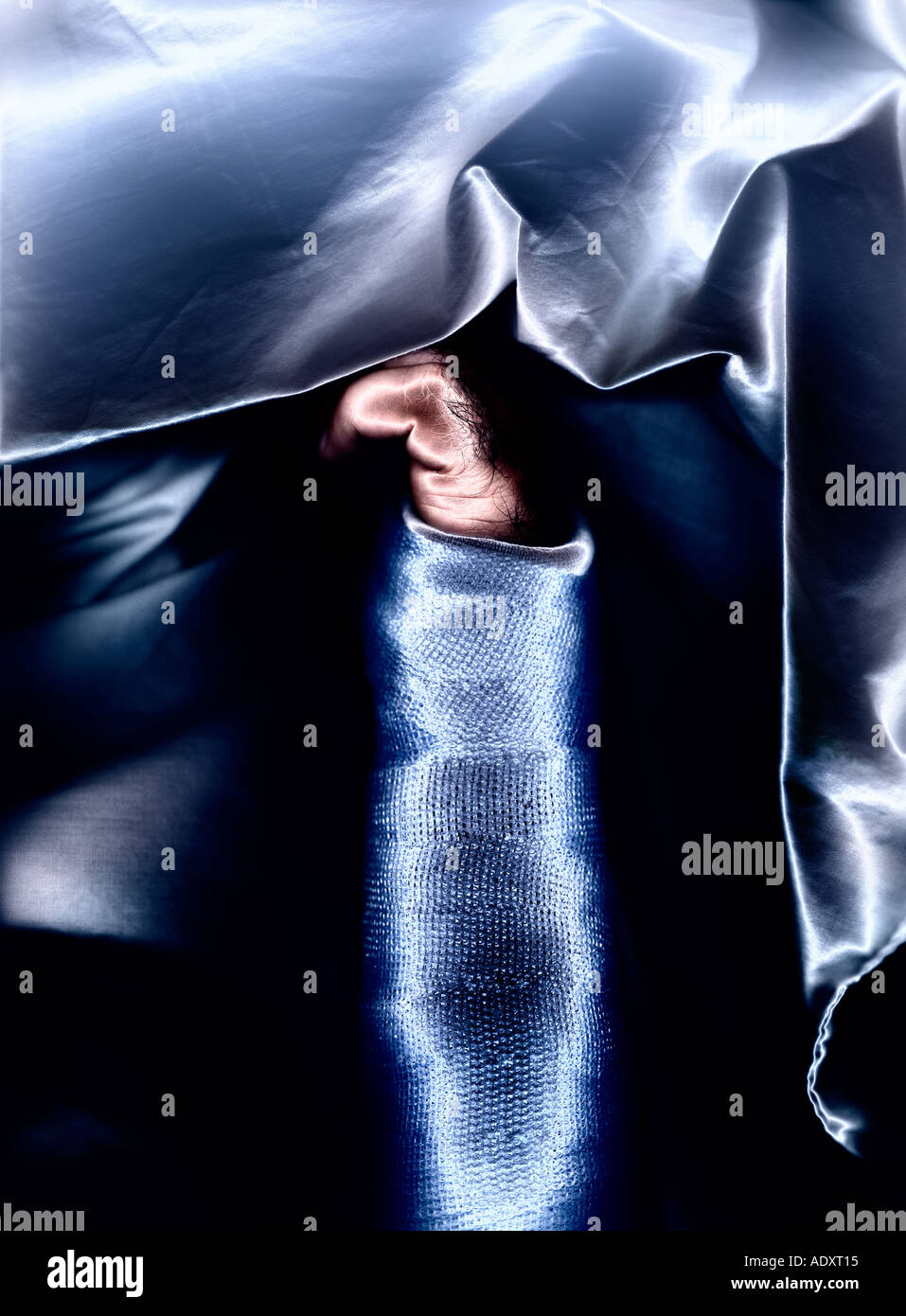 Studio shot of a fractured wrist in a fiberglass cast Stock Photo - Alamy