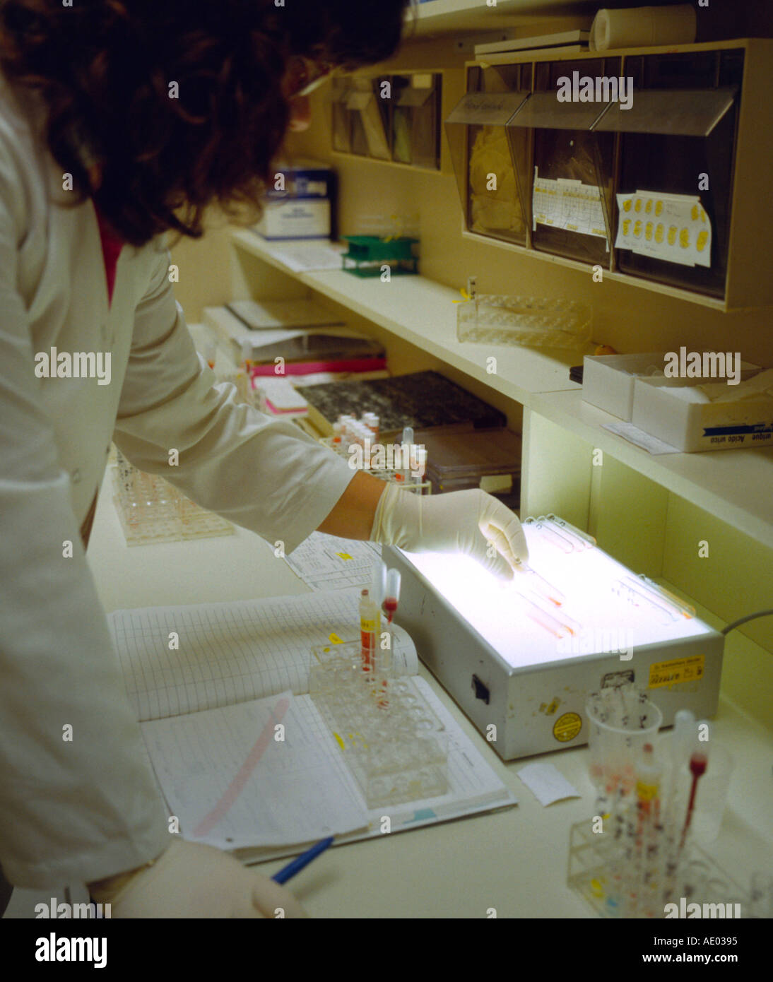Bloodtest in a laboratory Stock Photo - Alamy