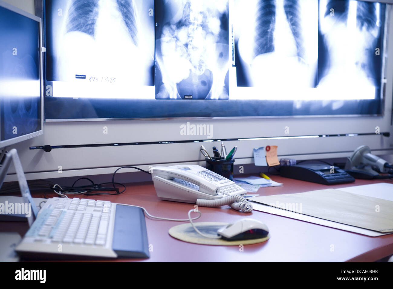 Backlit x rays hi-res stock photography and images - Alamy