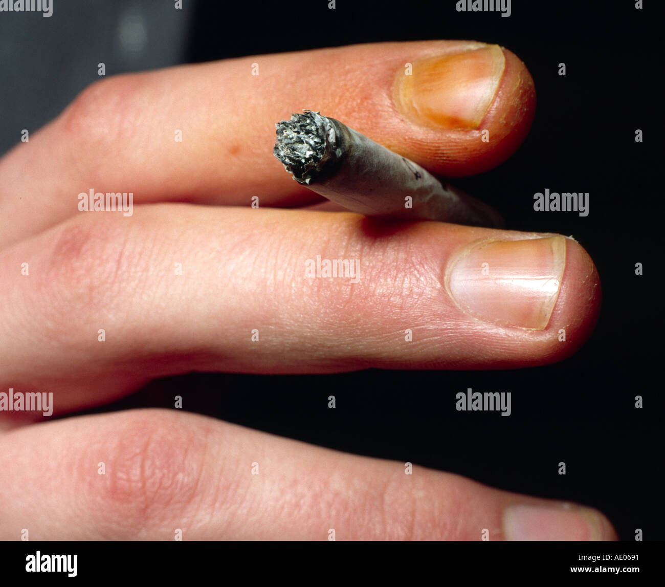 Yellow Fingernails From Smoking