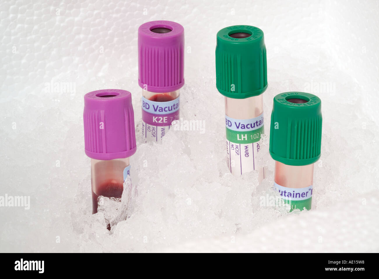Vacutainer blood tube hi-res stock photography and images - Alamy