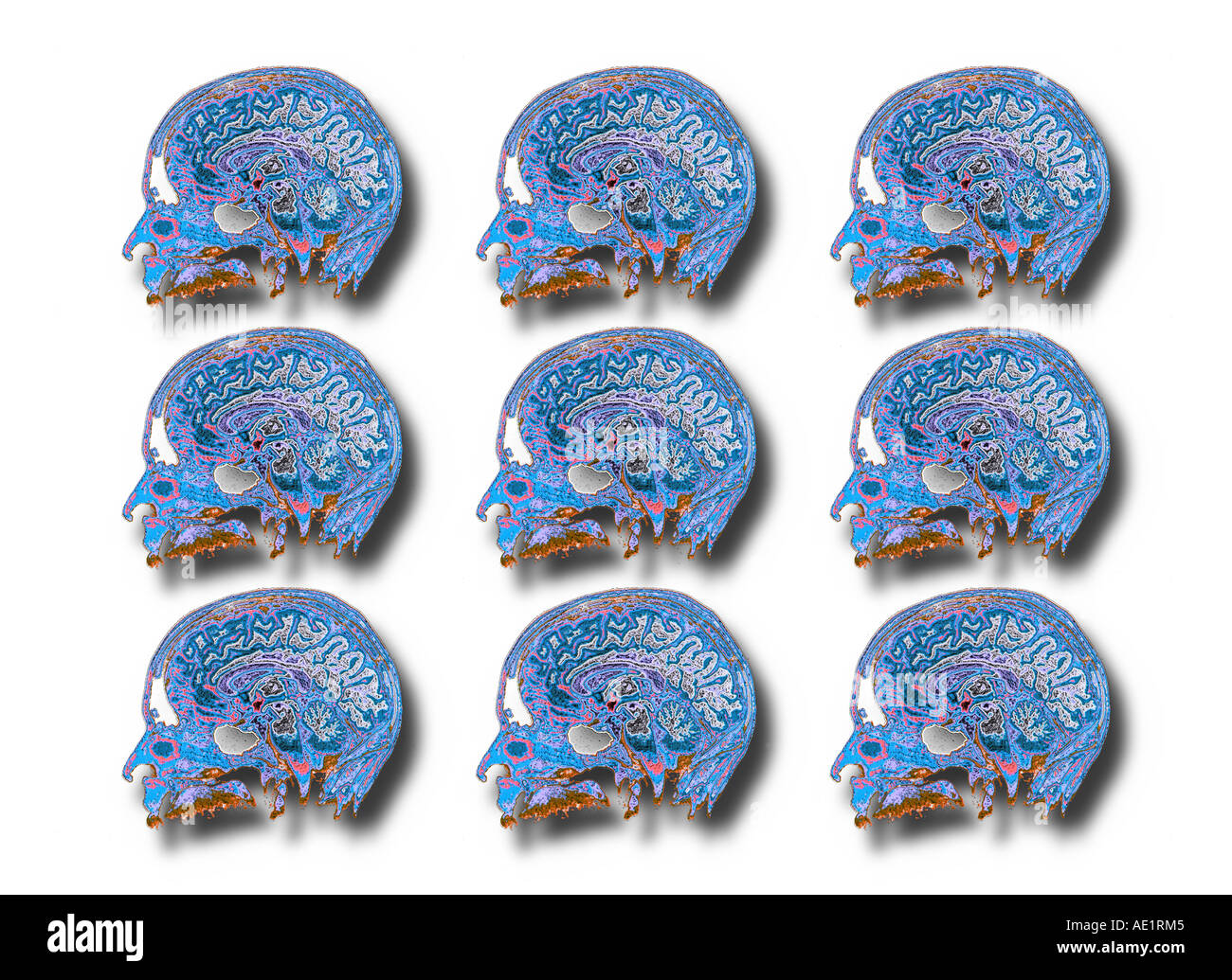 color coded tiled x-ray skulls Stock Photo - Alamy
