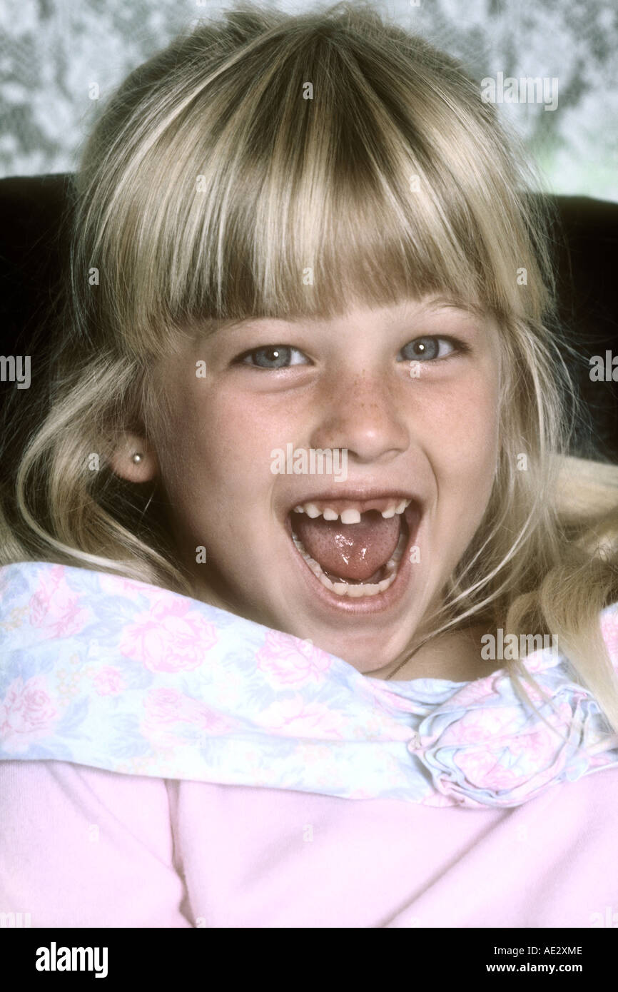 Girl with missing front tooth Stock Photo - Alamy