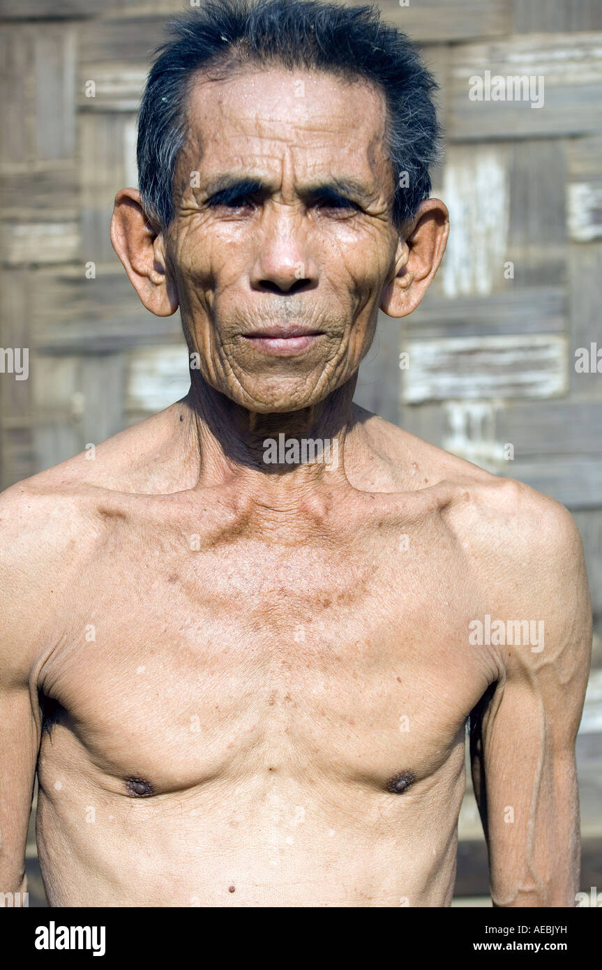 Concave Ribs High Resolution Stock Photography and Images - Alamy