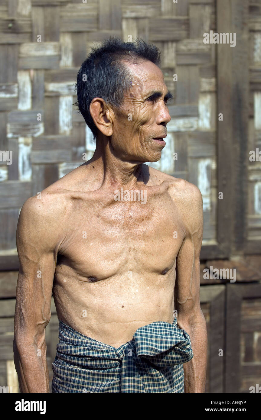 Concave Ribs High Resolution Stock Photography and Images - Alamy