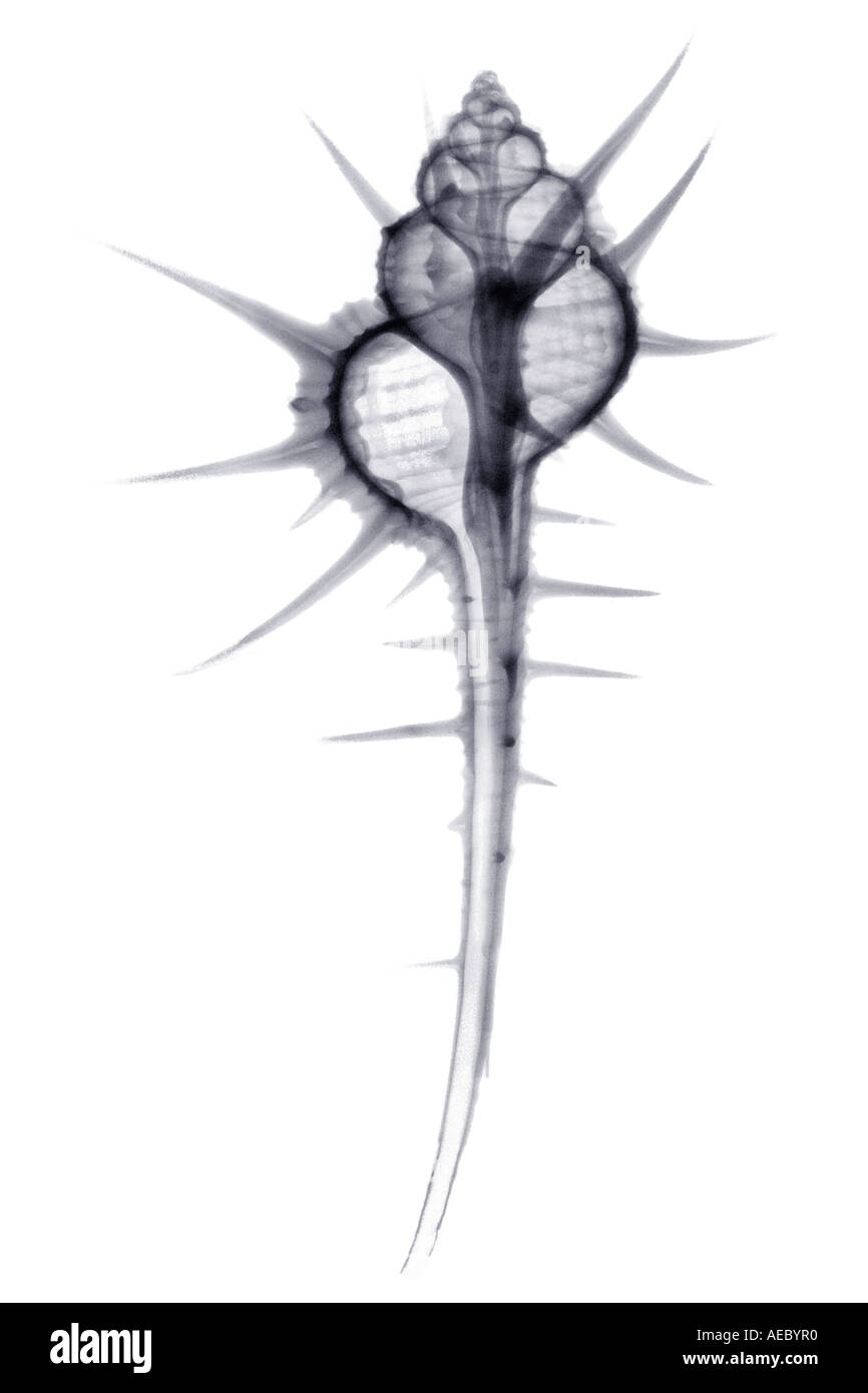 X-ray radiograph of a murex (Murex tribulus tenuirostrum). Radiographie ...