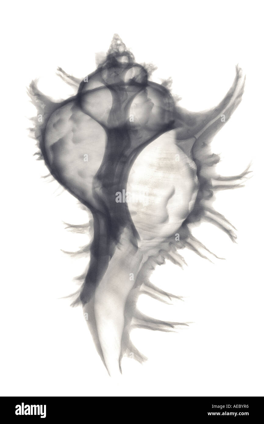 X-ray photograph of a murex ramosus (Chicoreus ramosus). Radiographie d ...