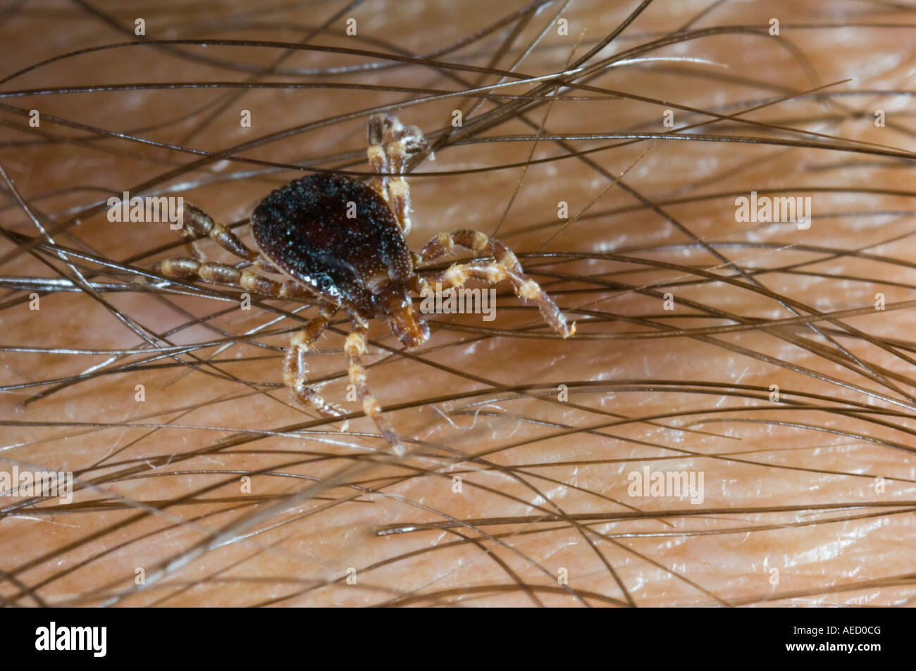 Tick (Hyalomma lusitanicum) on human arm, Spain Stock Photo - Alamy