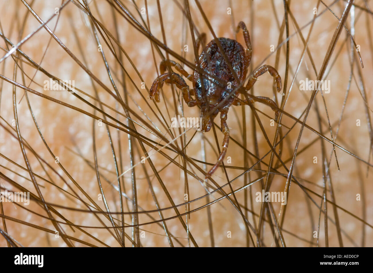 Tick (Hyalomma lusitanicum) on human arm, Spain Stock Photo - Alamy