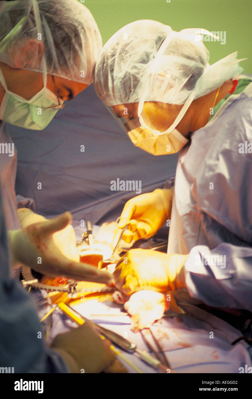 Operating room surgeons performing surgery Stock Photo - Alamy Operating room surgeons performing surgery Stock Photo - Alamy