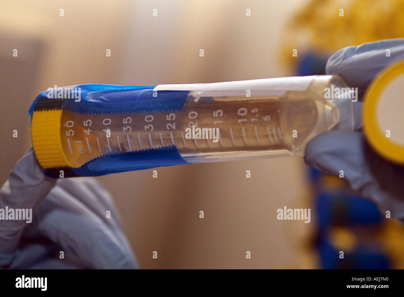 Sample file, containing piec of human bone for DNA analysis Stock Photo ...