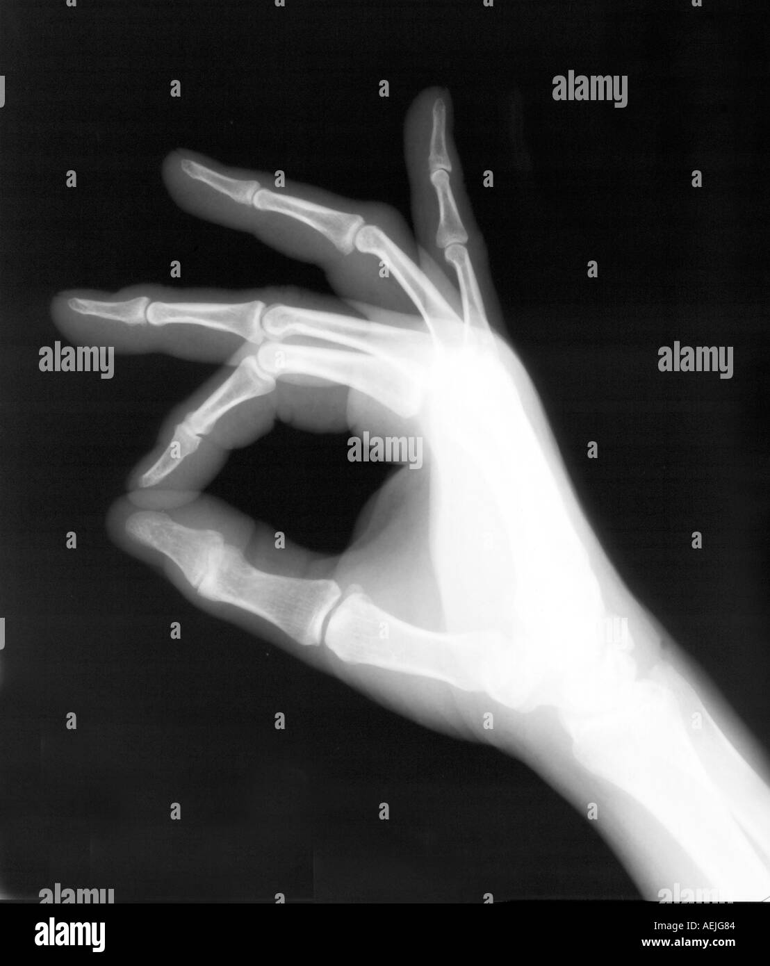 X ray of the hand making the okay gesture Stock Photo - Alamy