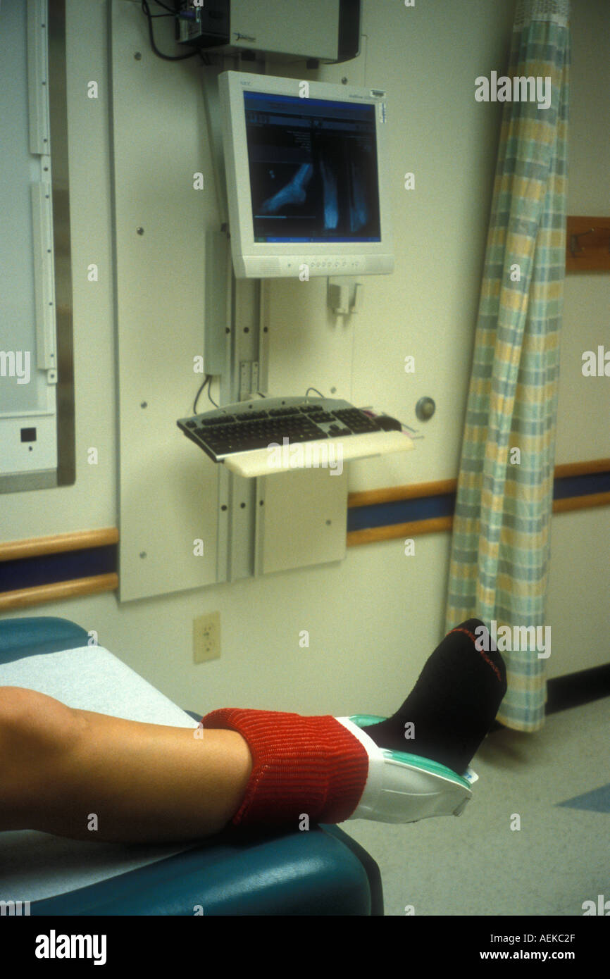 Girl With Leg Cast Stock Photos & Girl With Leg Cast Stock Images - Alamy