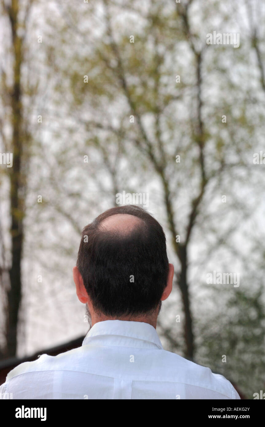 Balding head back view hi-res stock photography and images - Alamy