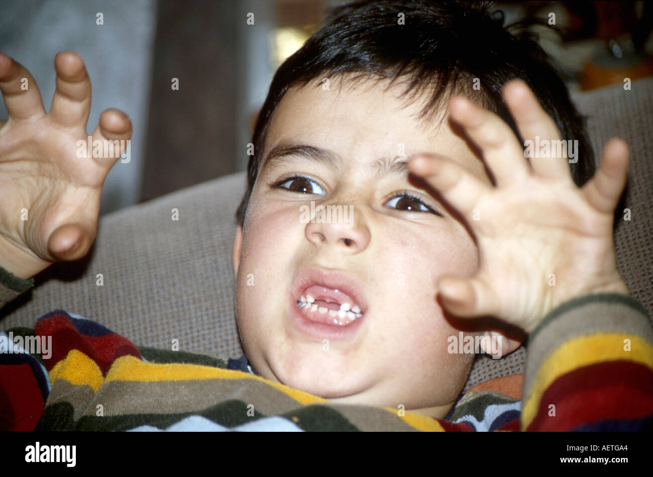 Model released portrait of a kid with no teeth doing a face Nano Calvo ...