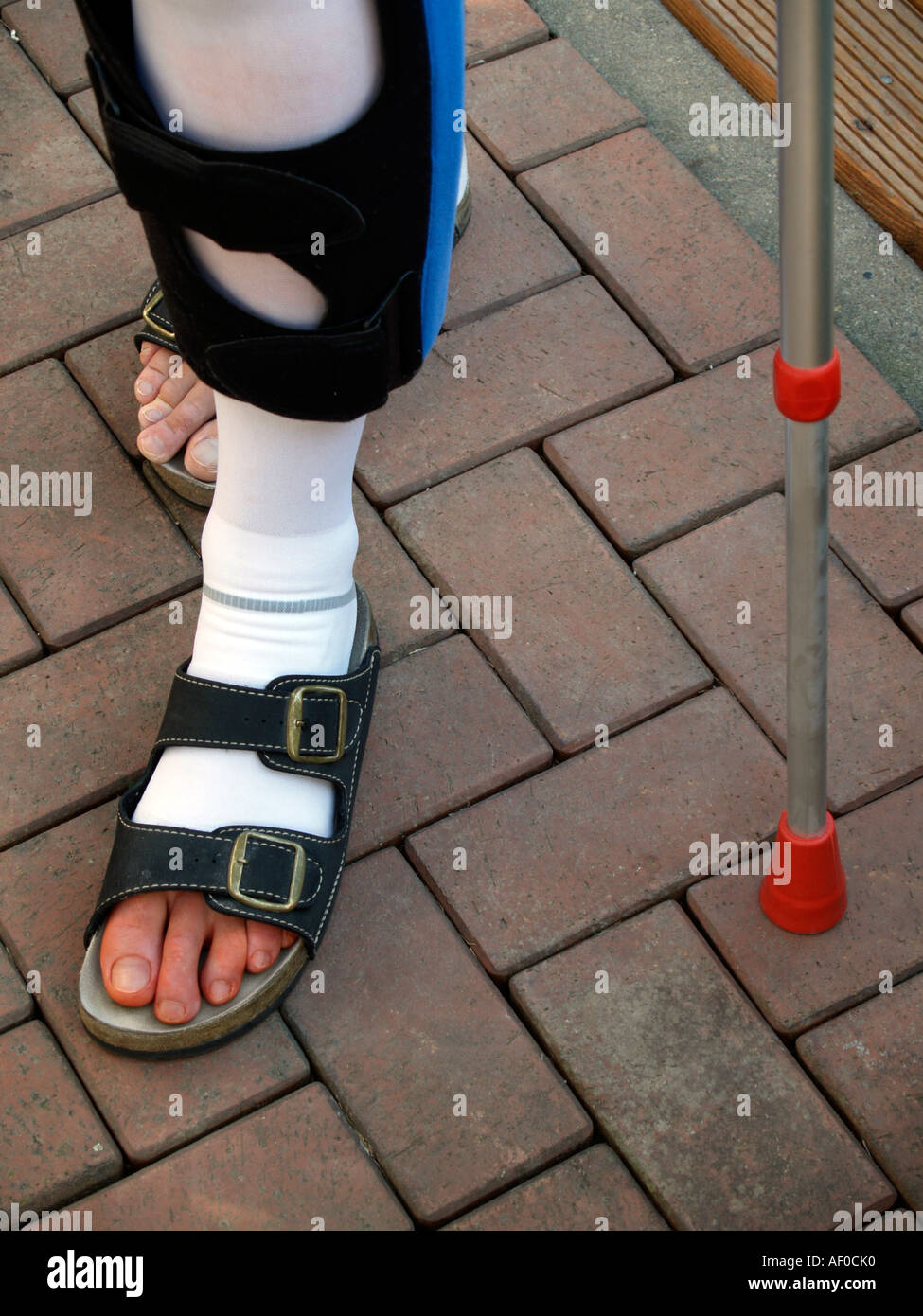 MR person man after operation with broken hurt leg Stock Photo - Alamy