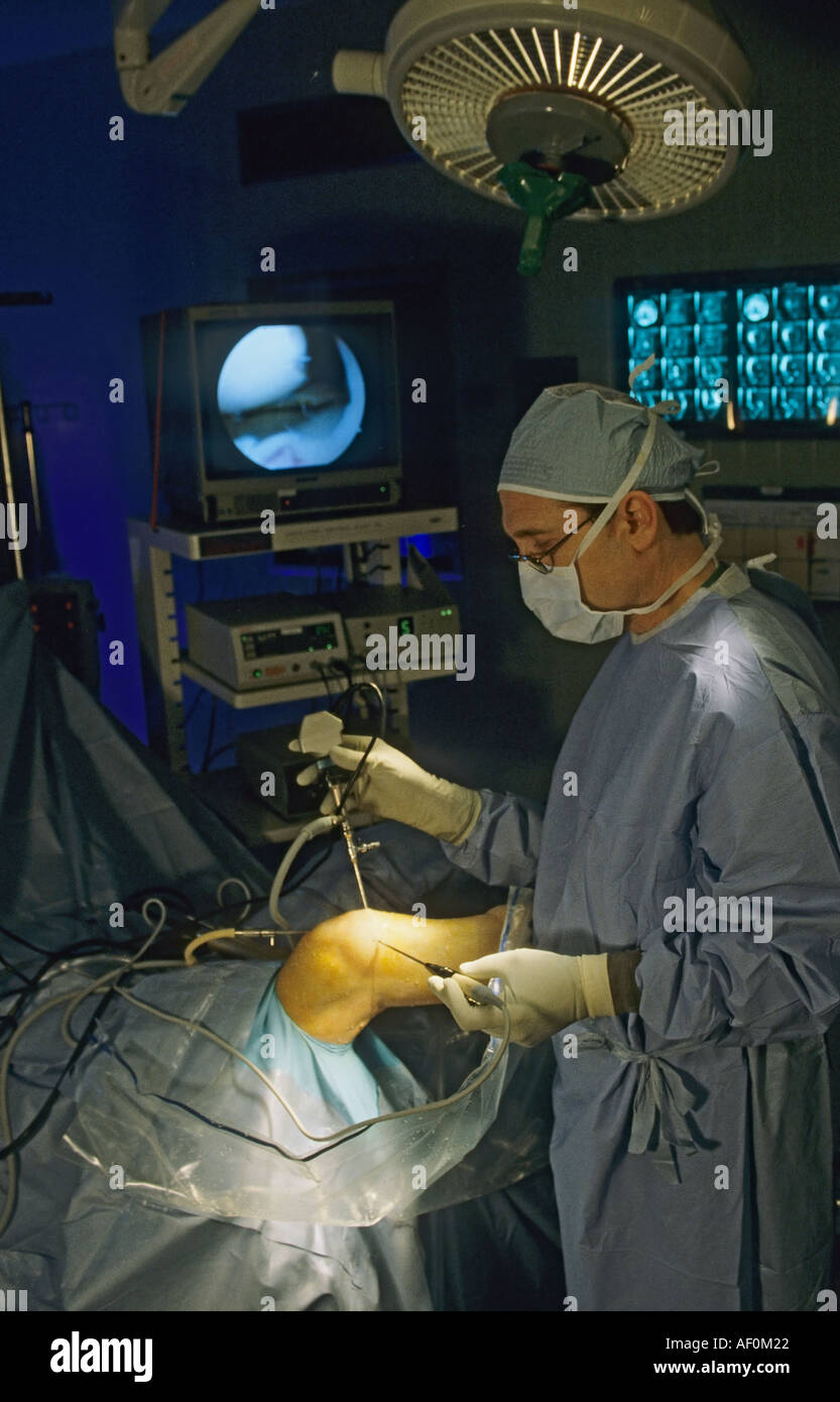 doctor performing knee Athroscopic Surgery in operating room Stock ...