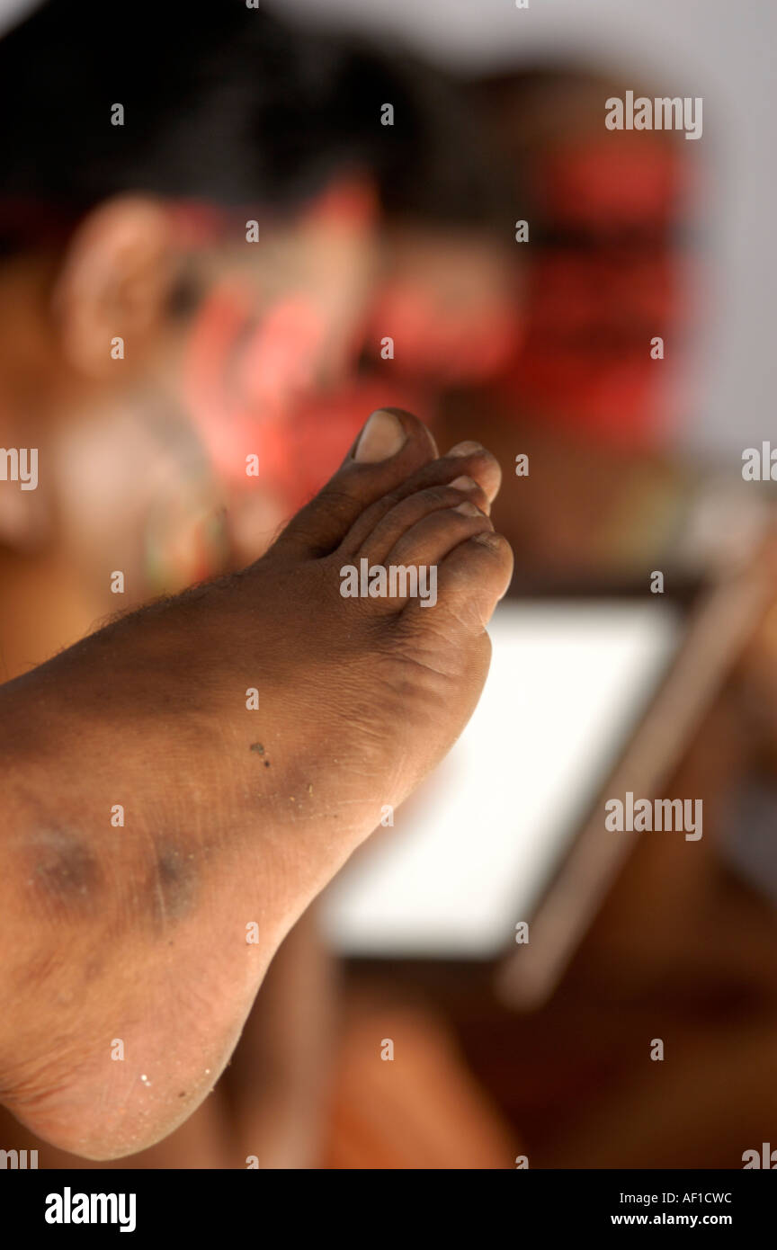 MAKE UP FOR KATHAKALI, CHUTTI KUTHAL Stock Photo - Alamy