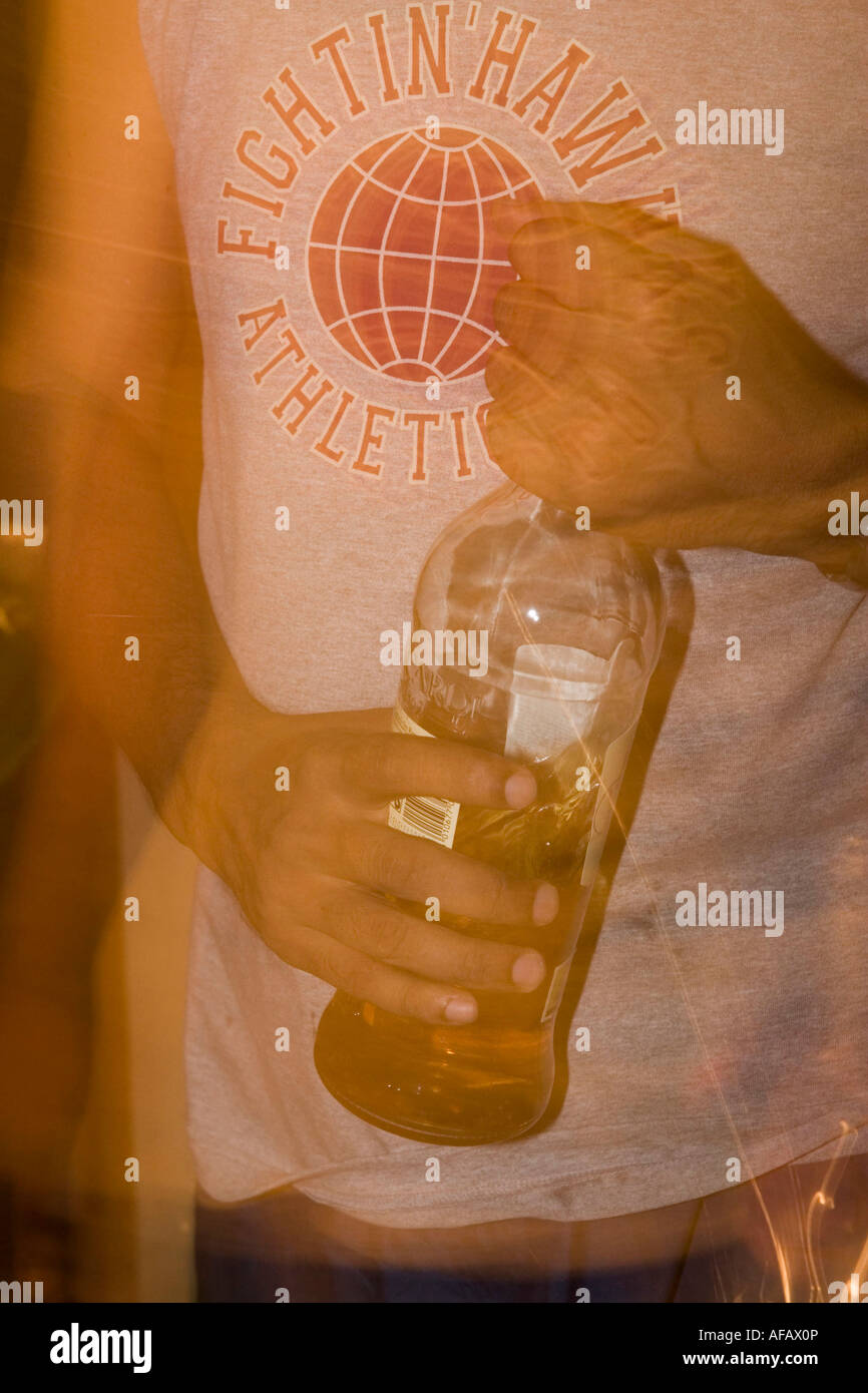 Blood culture bottle hi-res stock photography and images - Alamy