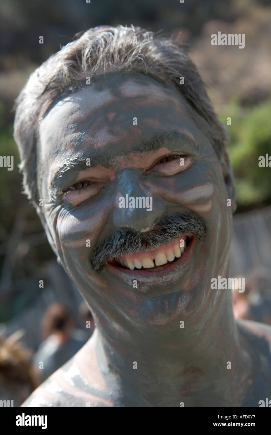 Mud-Faced Man, Dalyan River Mud Baths Dalyan River, Turkey Stock Photo ...
