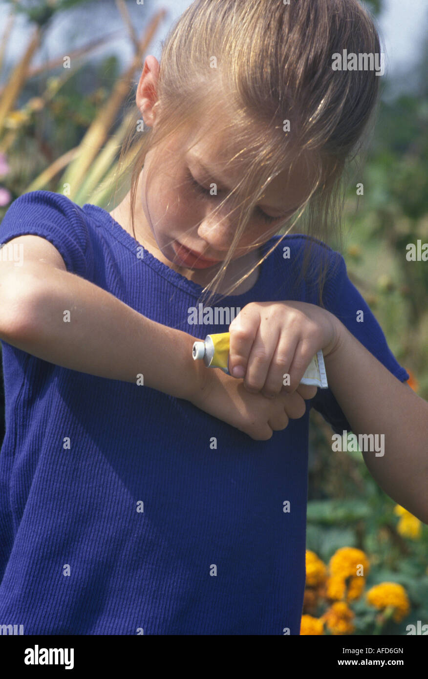 Insect bites child hi-res stock photography and images - Alamy