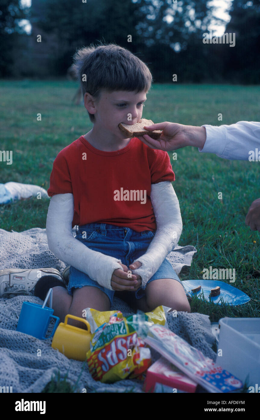 boy with broken arms being fed Stock Photo - Alamy