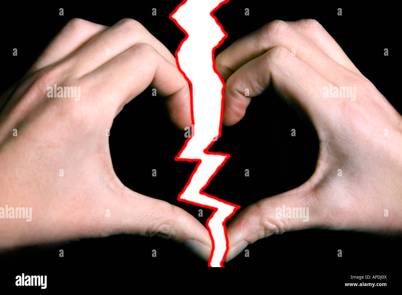 Broken thumb hi-res stock photography and images - Alamy