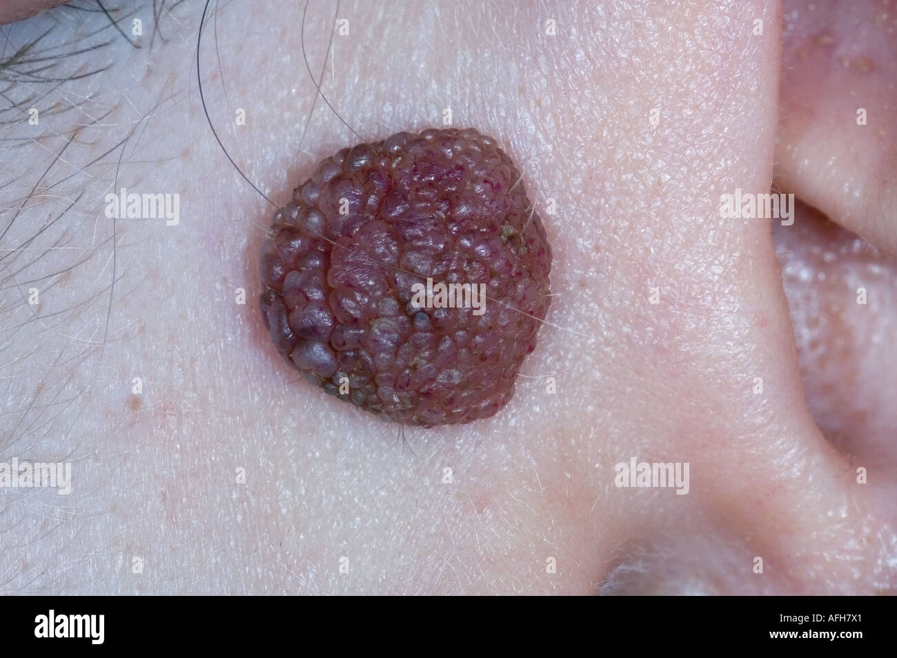 Fleshy face hi-res stock photography and images - Alamy