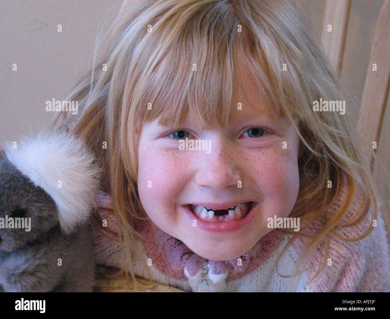 Little girl smiling with two front teeth missing Stock Photo - Alamy