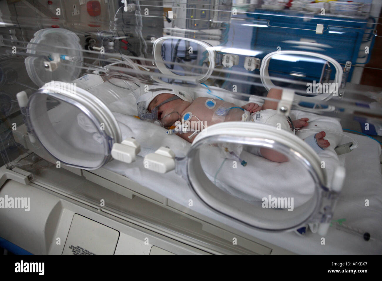 Baby oxygen incubator hi-res stock photography and images - Alamy