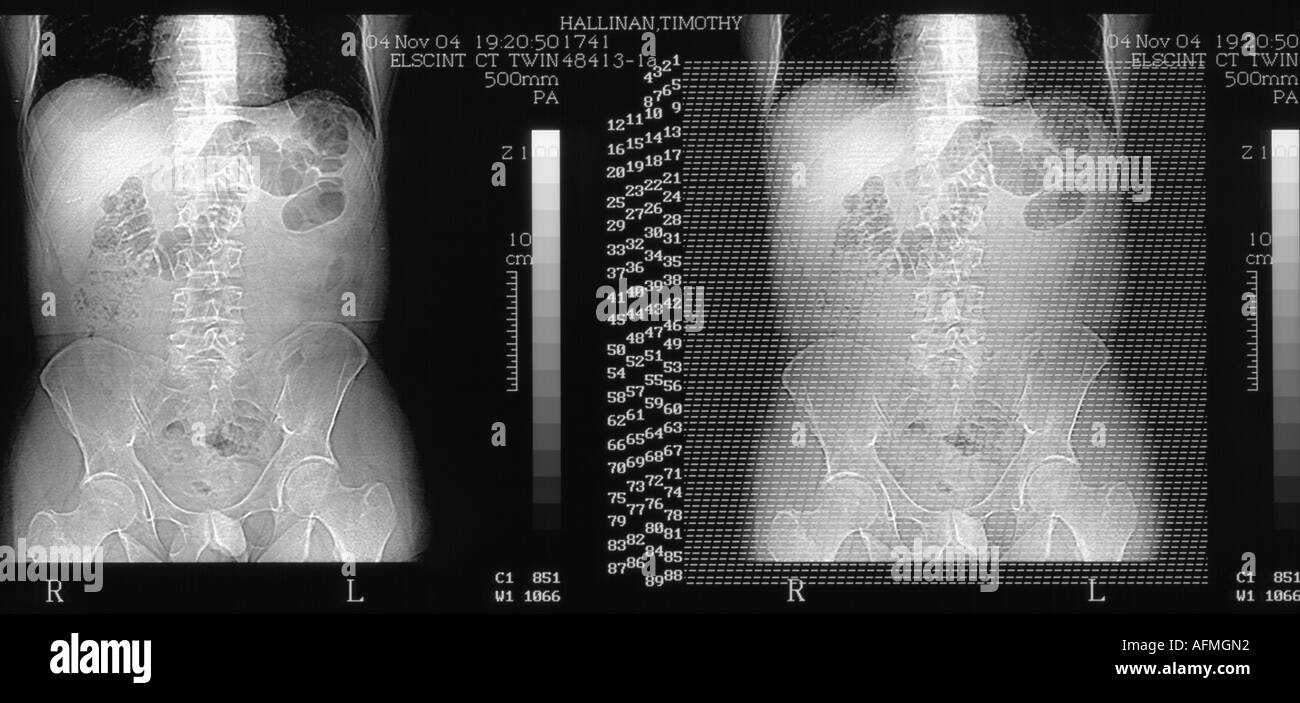 MRI scans of male body Stock Photo - Alamy