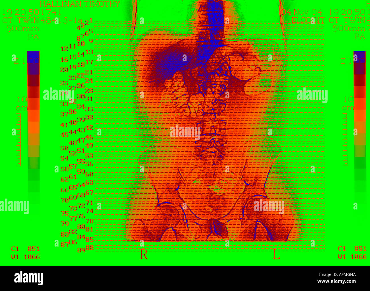 Brain Mri Imagery High Resolution Stock Photography and Images - Alamy