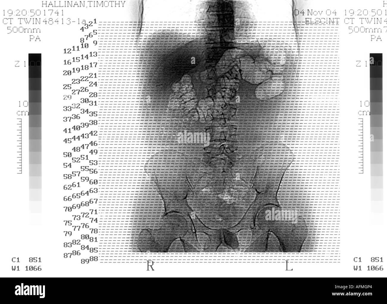 MRI scans of male body Stock Photo - Alamy