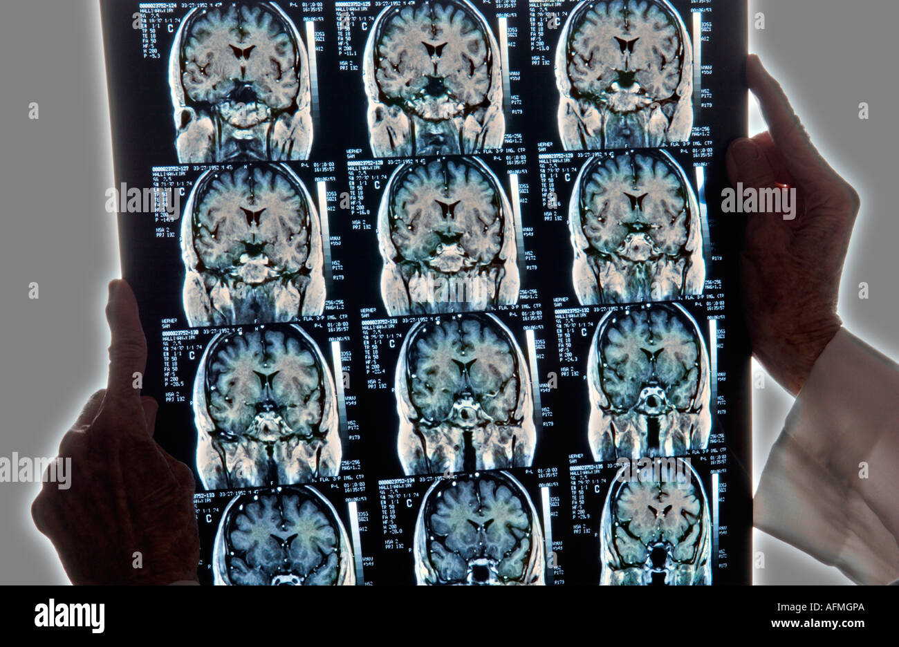 doctor examining x-rays of cerebral cortex cerebellum human brain Stock ...