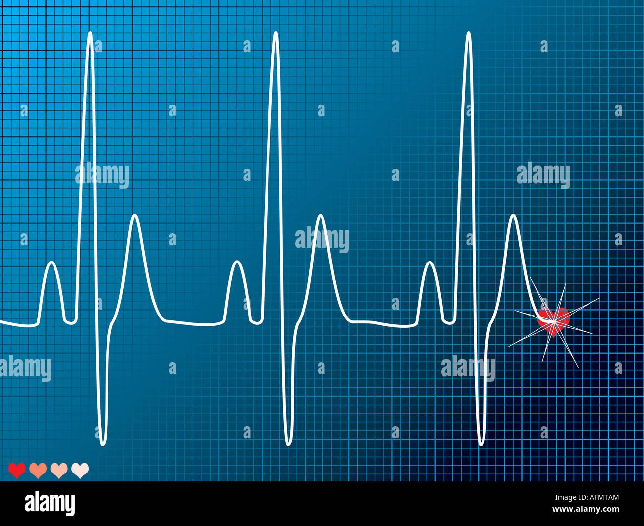 Medical abstract ecg monitor overlayed on an technical grid Stock Photo ...