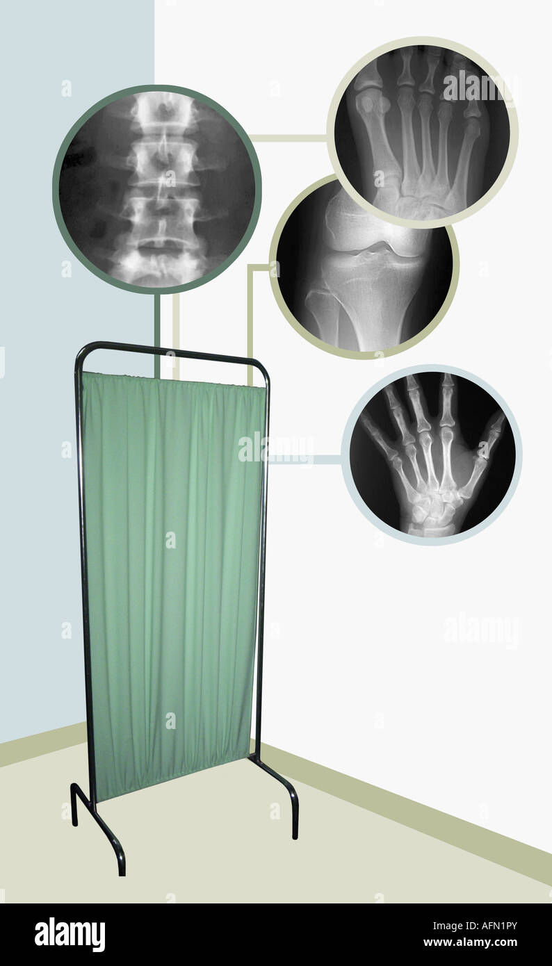 X Ray images over a hospital screen Stock Photo - Alamy