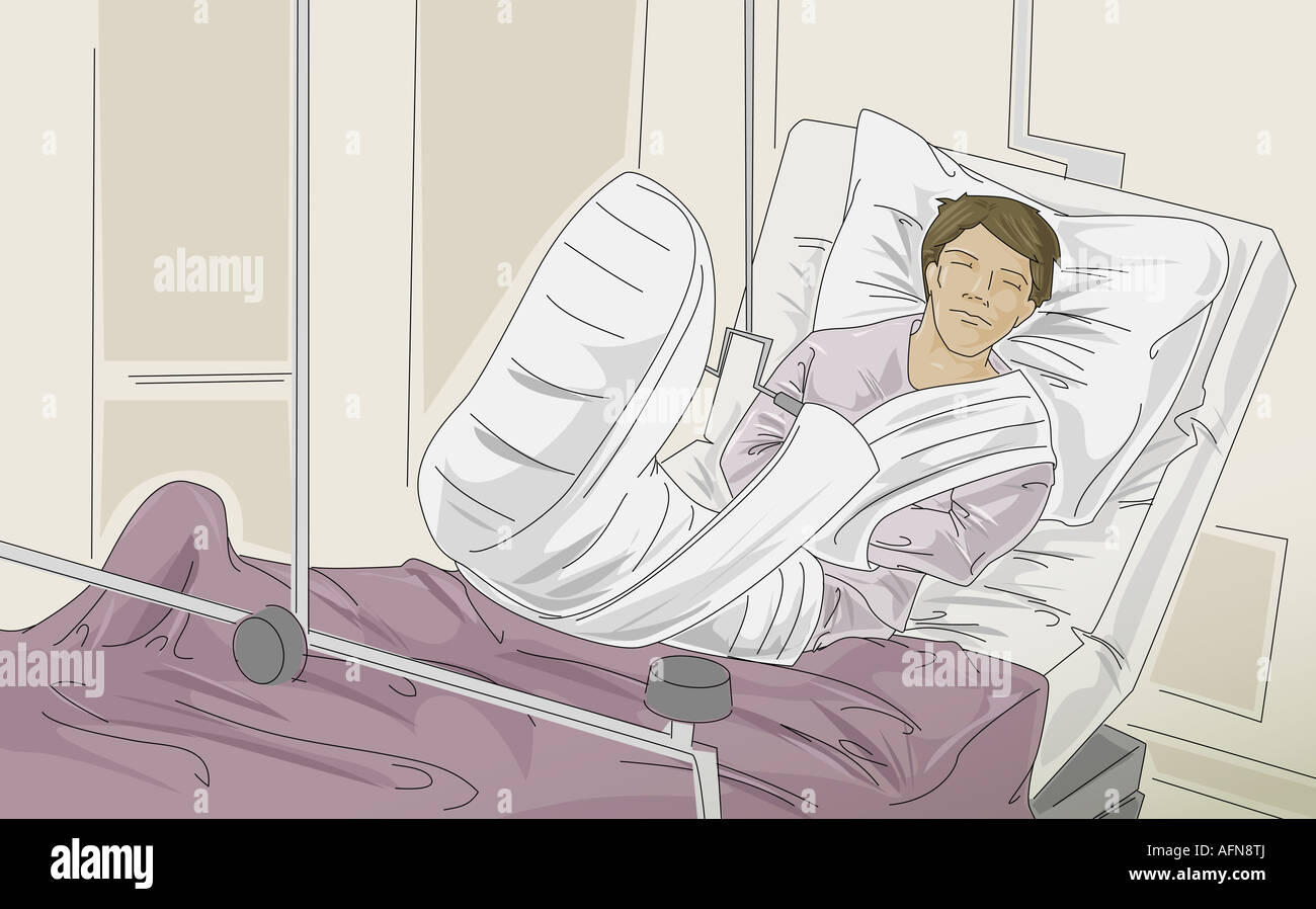 Male patient with a fractured leg on a hospital bed Stock Photo - Alamy