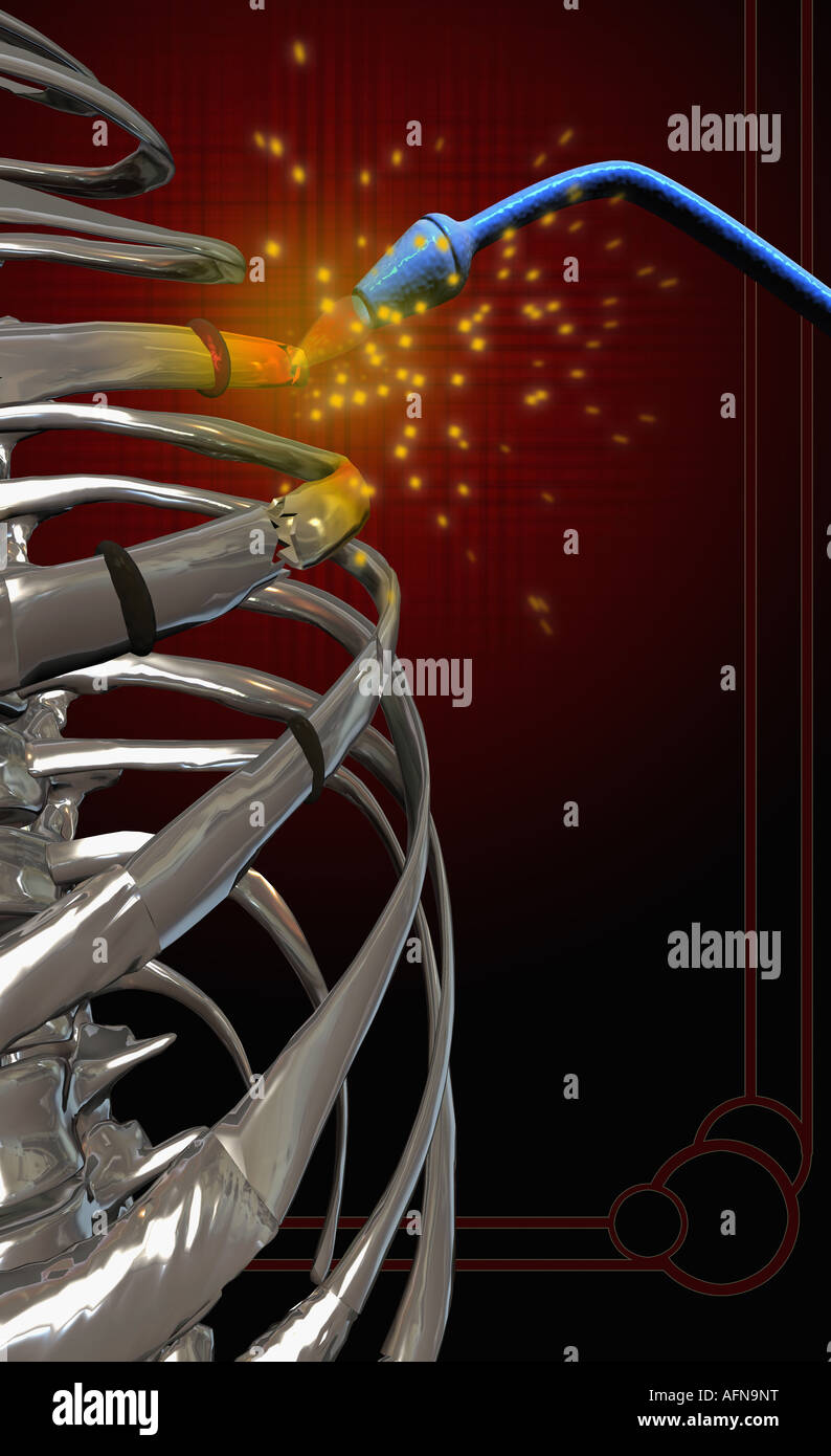 Welding torch welding human bones Stock Photo - Alamy