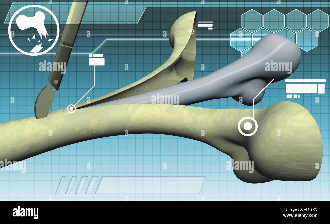 Human bone being cut with a scalpel Stock Photo - Alamy