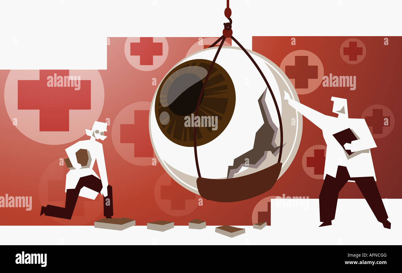 Doctors examining a damaged eyeball Stock Photo - Alamy